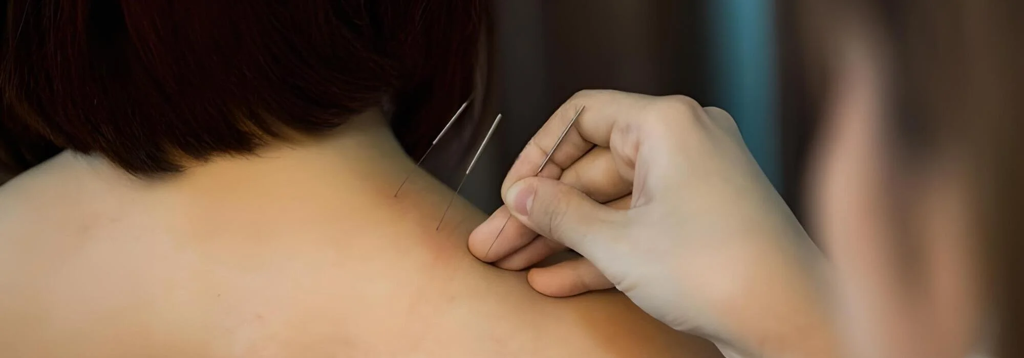 Punción seca en Valencia | NeoFisio